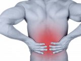 Radiculopatía Lumbar - Clínica Bienestar para tu columna